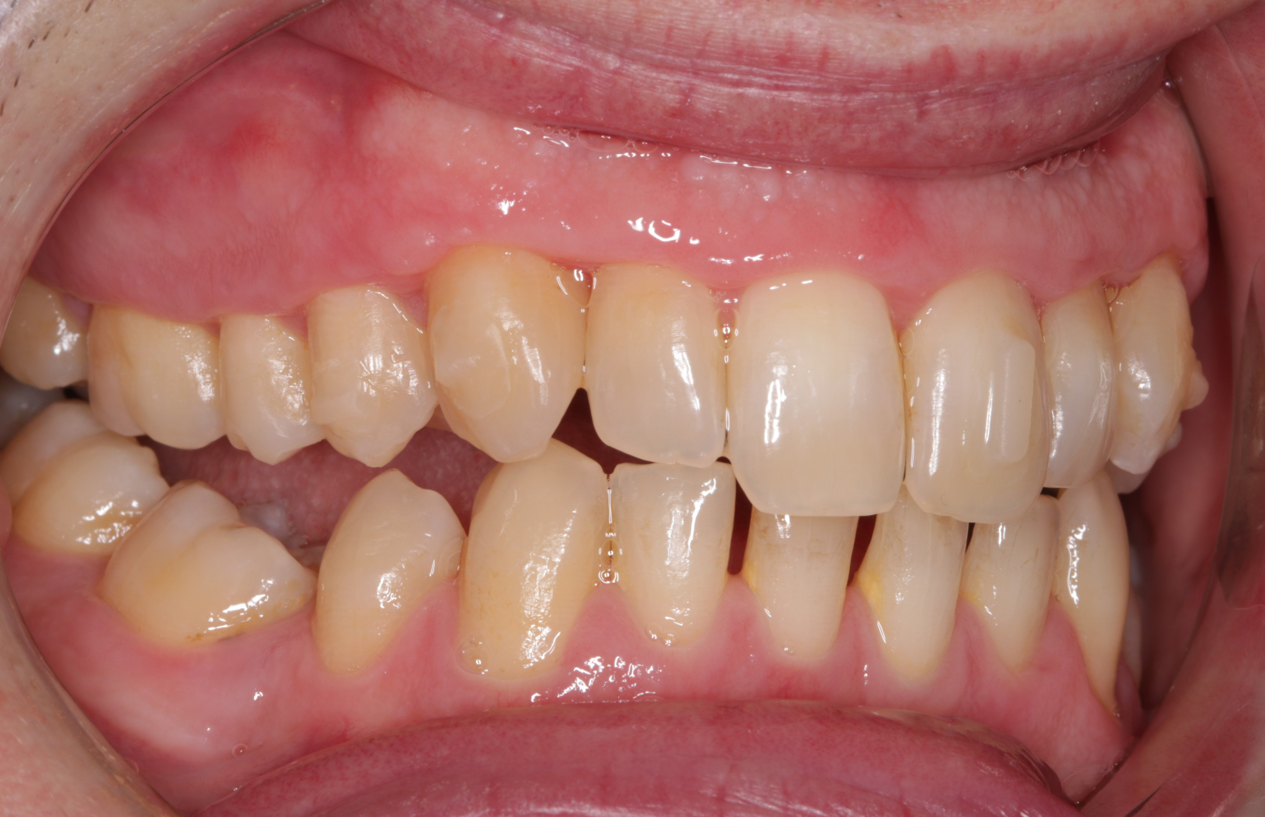 Dental News - Getting to grips with general dental practitioner ...