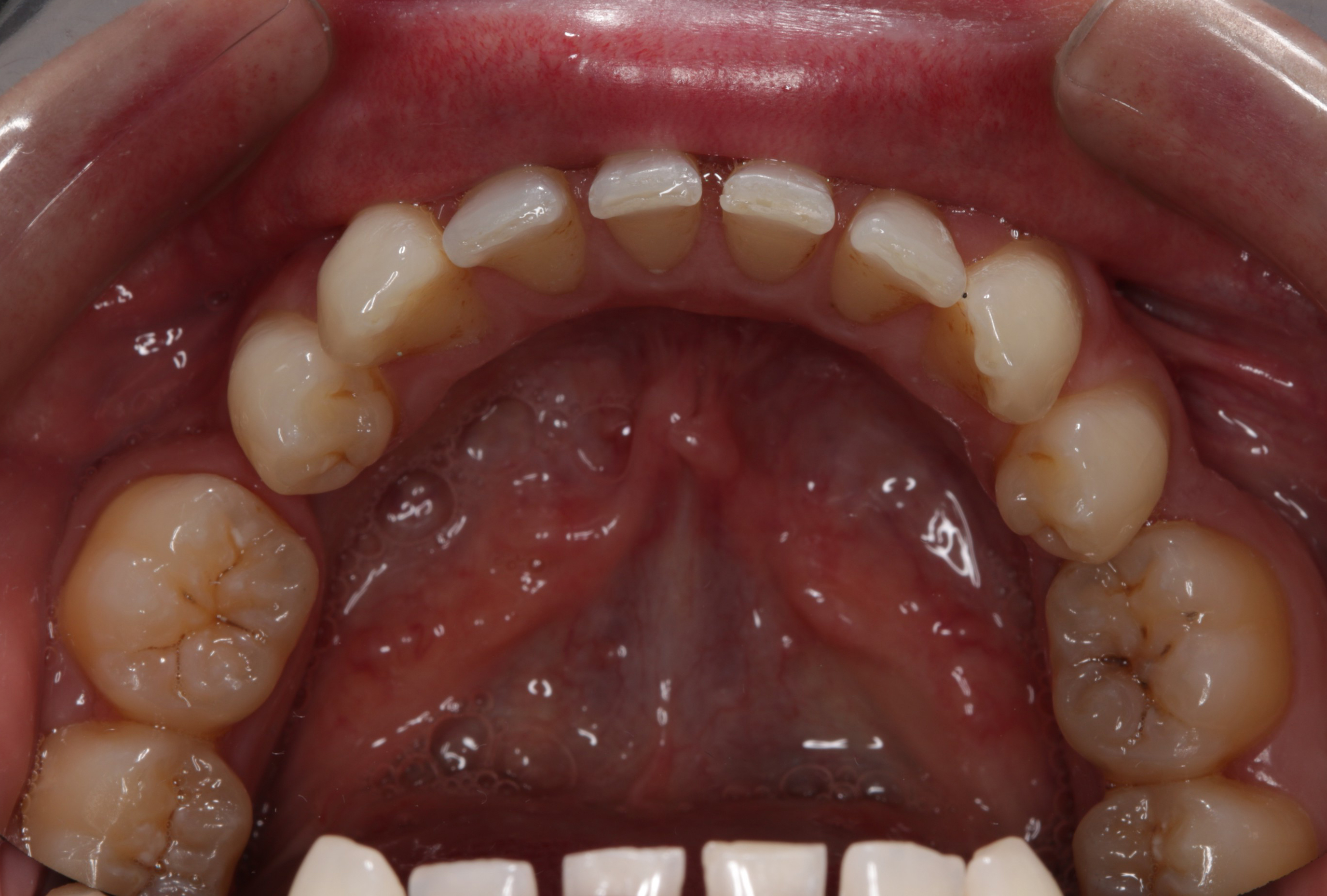 Dental News - Getting to grips with general dental practitioner ...