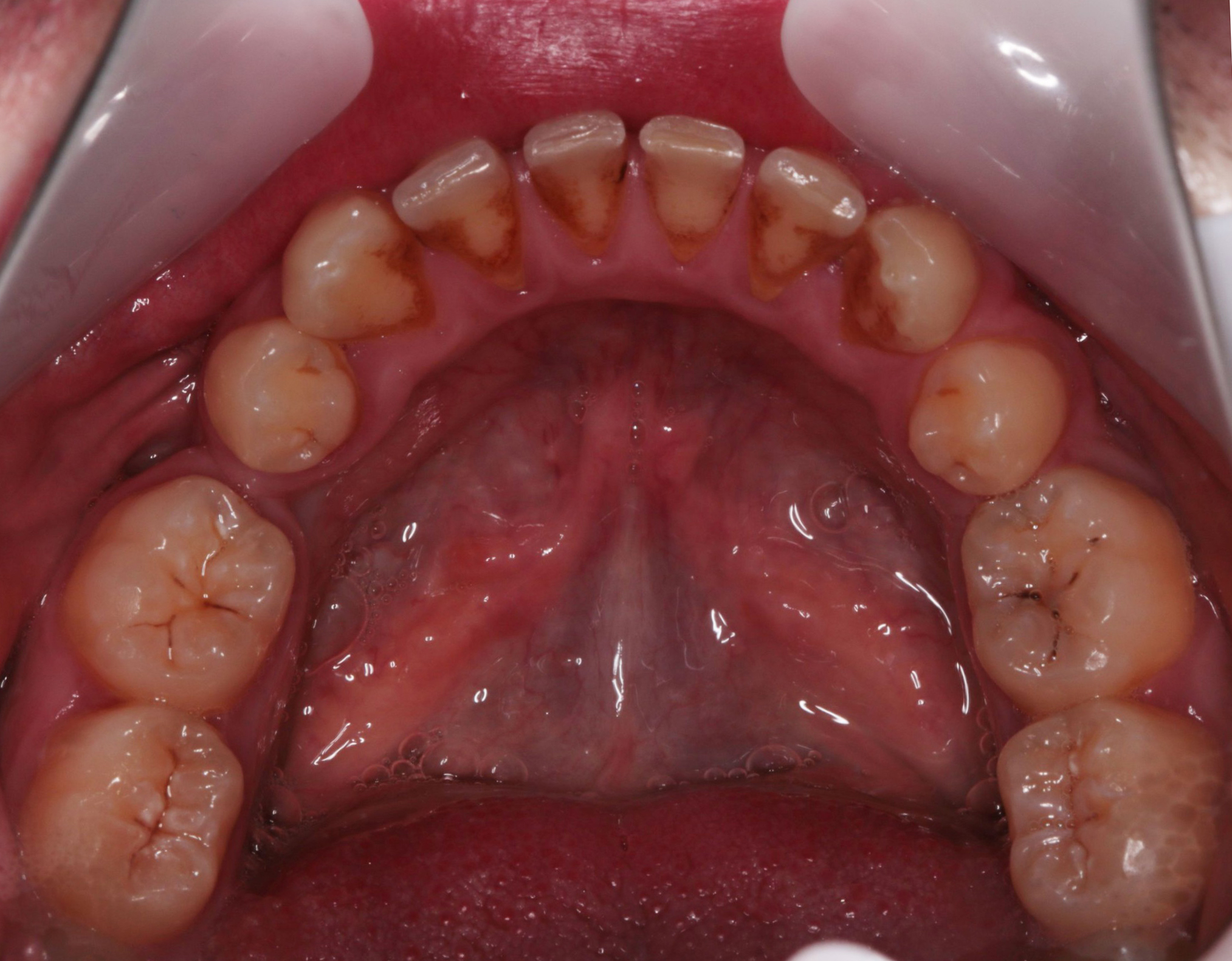 Dental News - Getting to grips with general dental practitioner ...